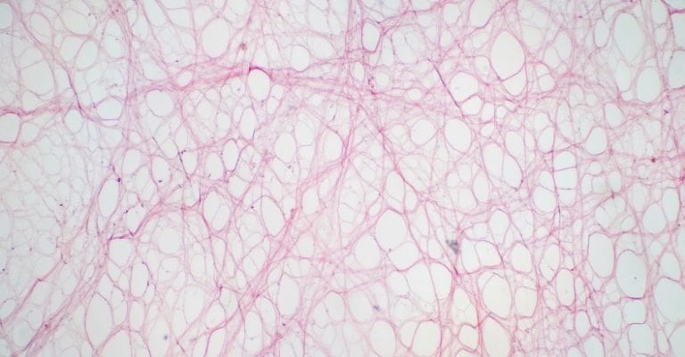 areolar-connective-tissue-under-the-microscope-view-histological-for ...