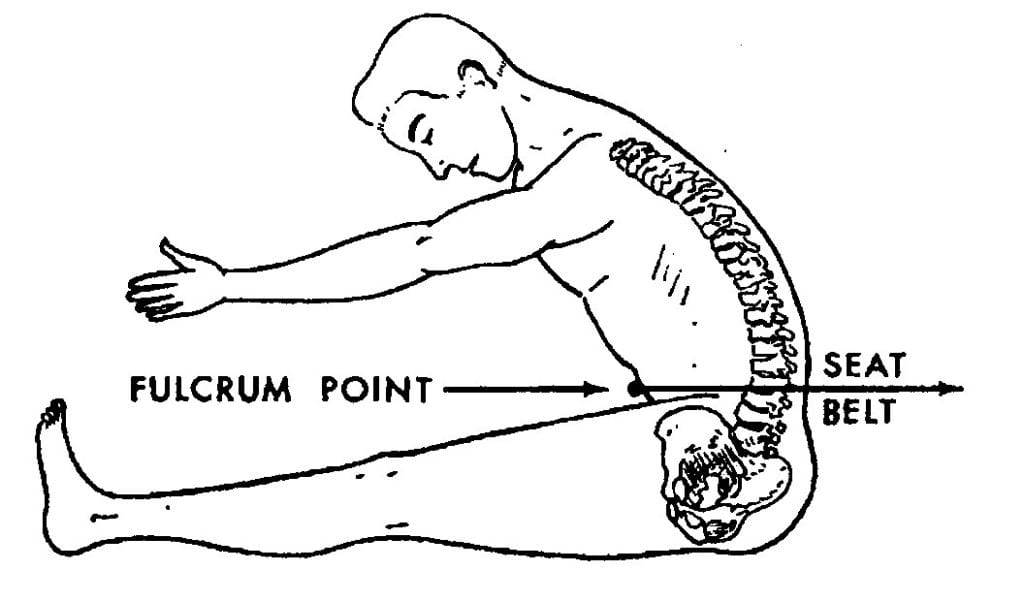 Motor Vehicle Crashes and Low Back Pain