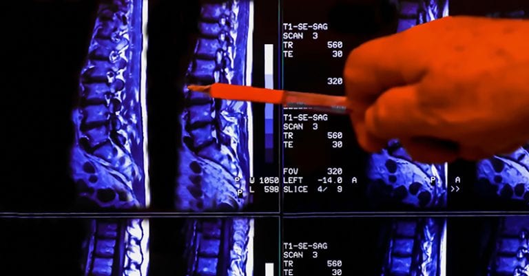 Doctor analyzes the results of magnetic resonance imaging of a patient ...