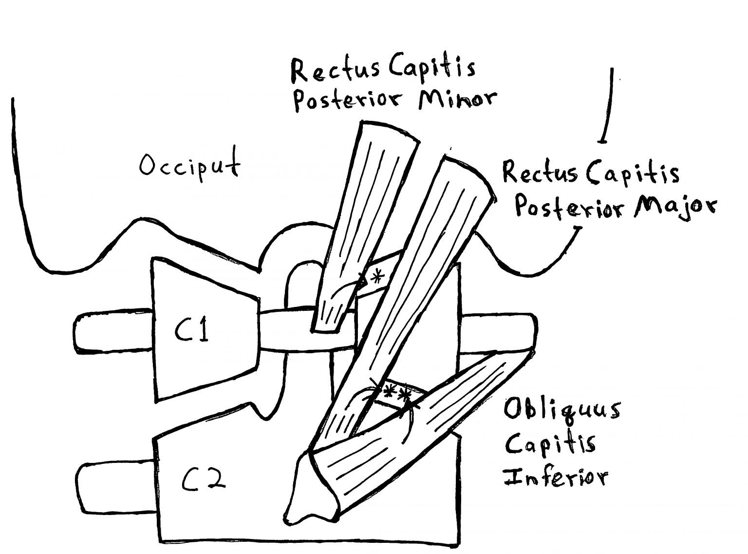 Understanding Whiplash Mechanics: Mechanical Factors that Protect ...