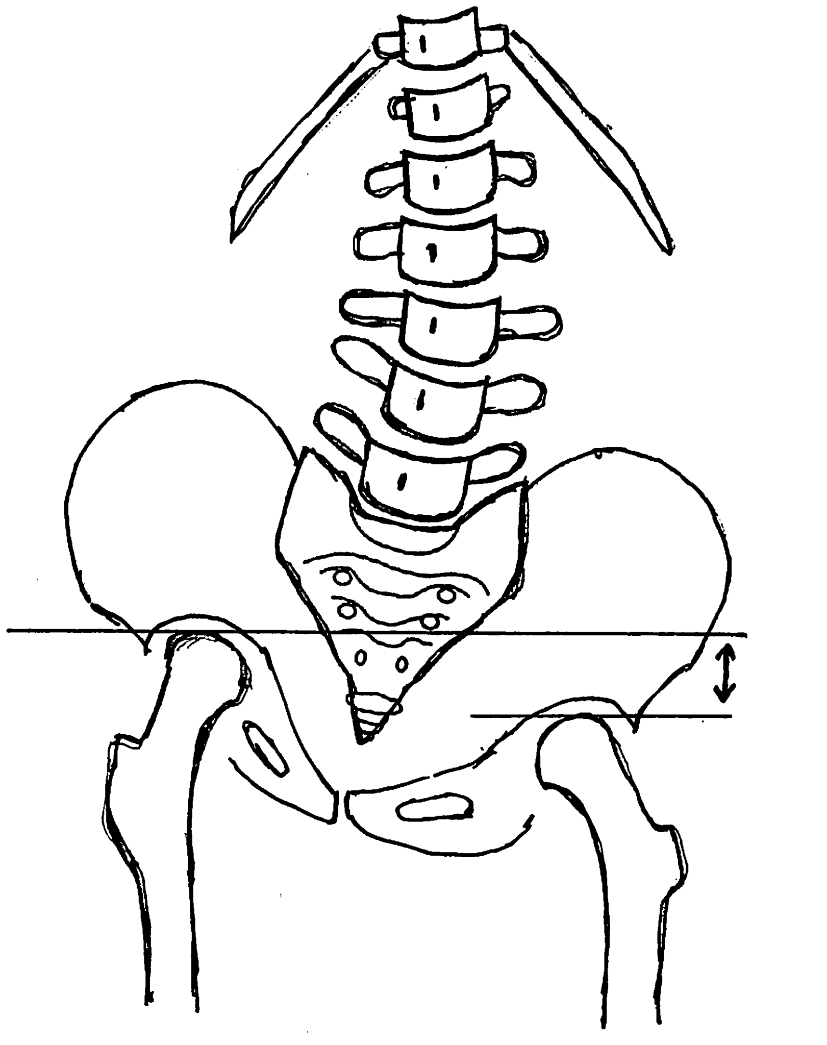 Anatomical Short Leg Length